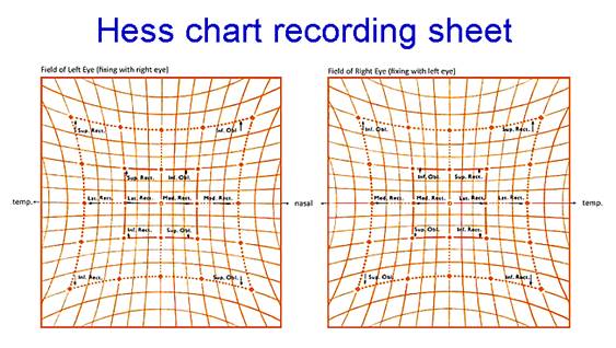 自製Hess Chart Lancaster Chart